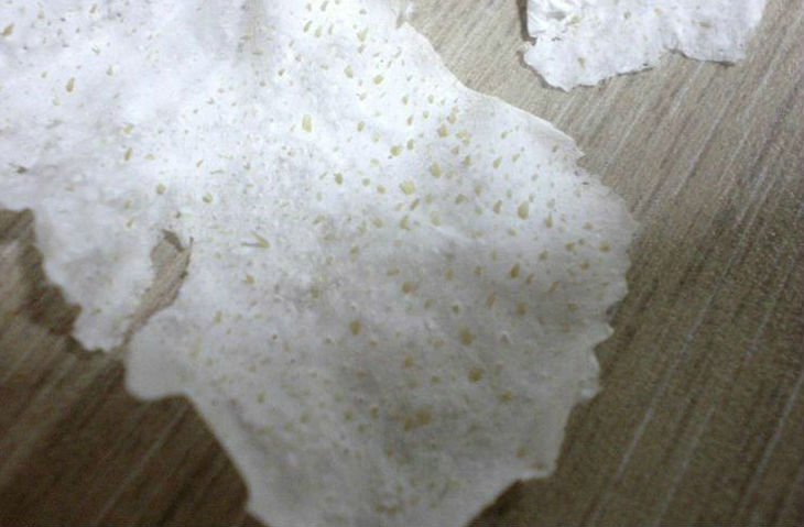 Rešite se mitisera preko noći | LifePress magazin